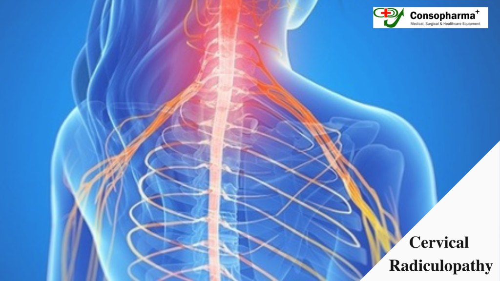 Cervical Cervical
